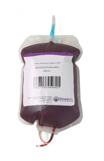 Human Whole Blood - Research Donors