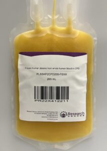 Human Blood Plasma - Research Donors