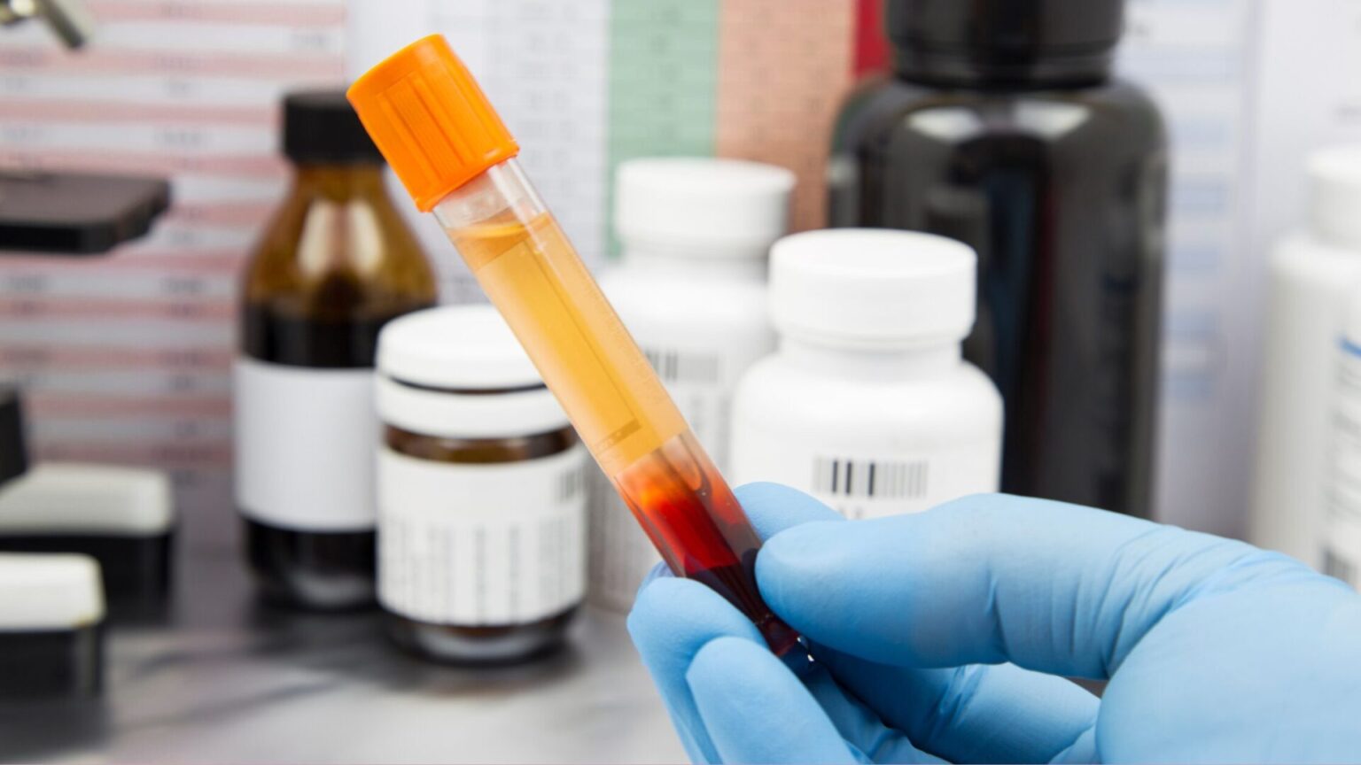 Choosing the Right Blood Biospecimens Supplier